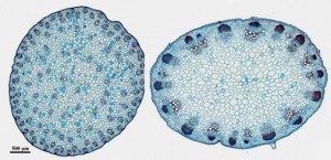 A estrutura interna do Caule - Aula de Biologia Enem
